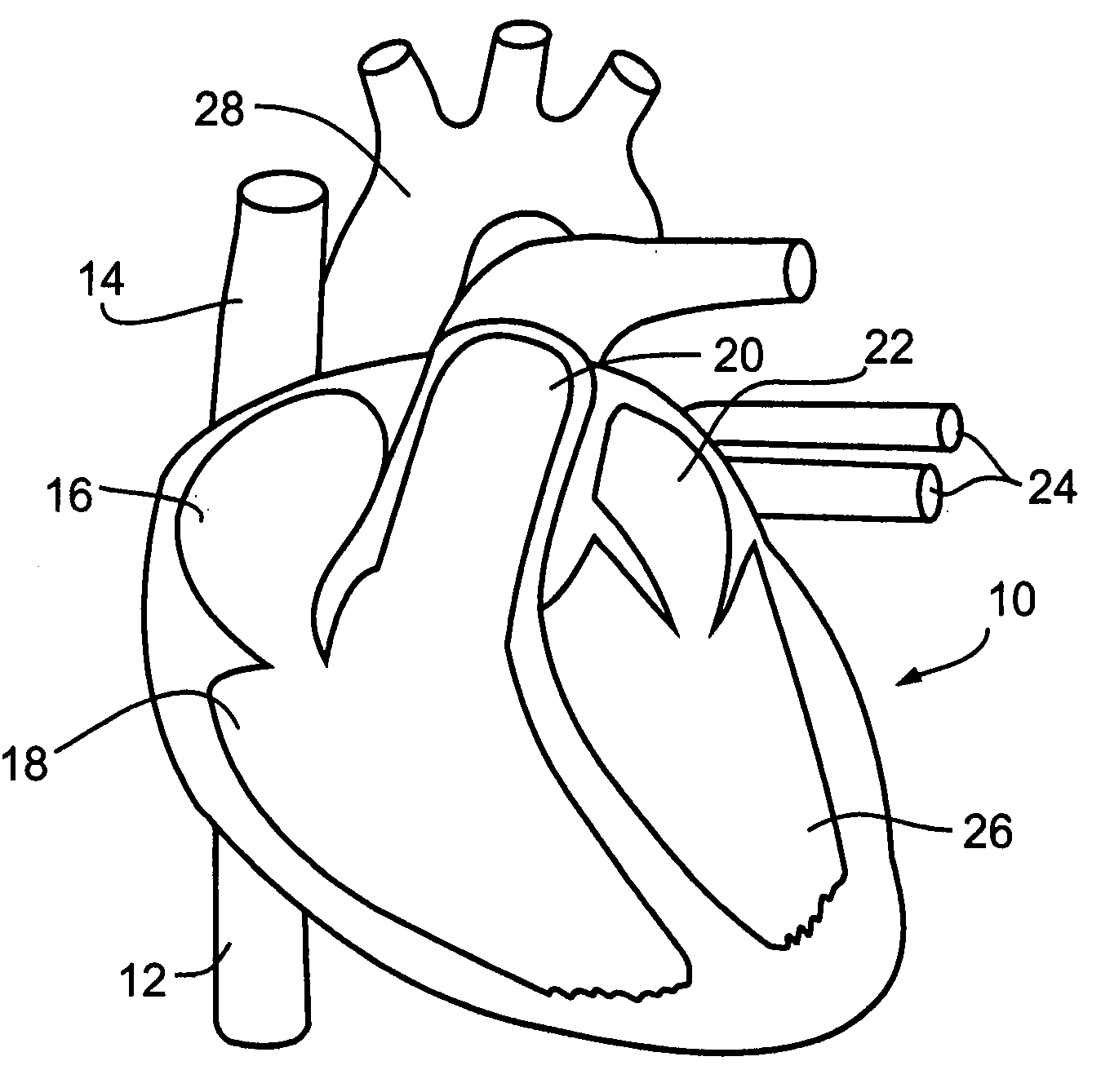 Cardiovascular System Drawing At GetDrawings Free Download Cardiovascular System Drawing At GetDrawings Free Download